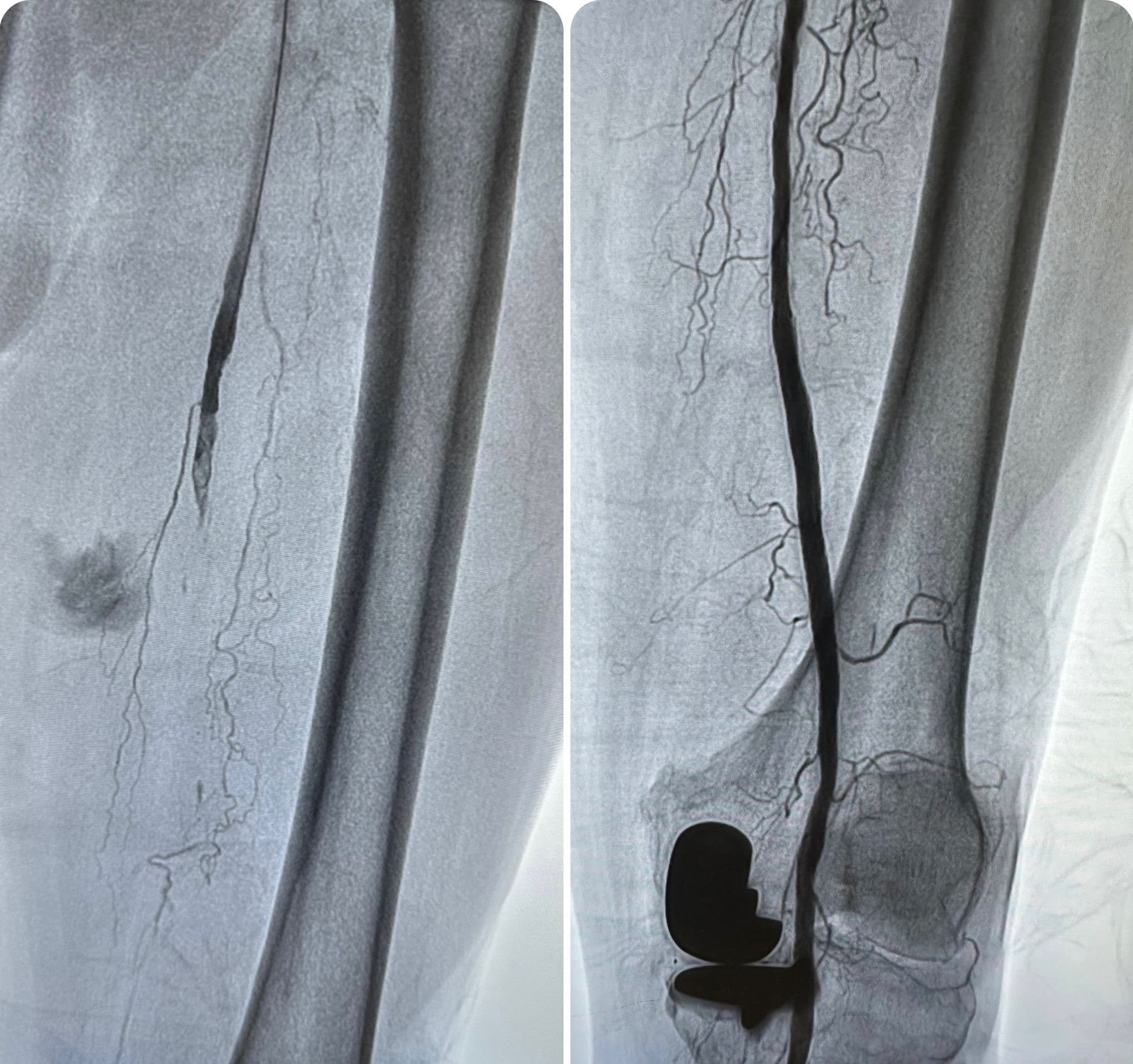 Surgical Procedures - Cigarroa Clinic